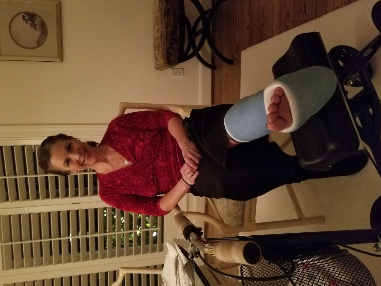 This was Christmas 3 weeks after my accident. Cast is off now but still ...